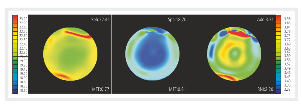 Supra Phob Regen - Appasamy Hydrophobic Acrylic Lens/ Surgical IOL